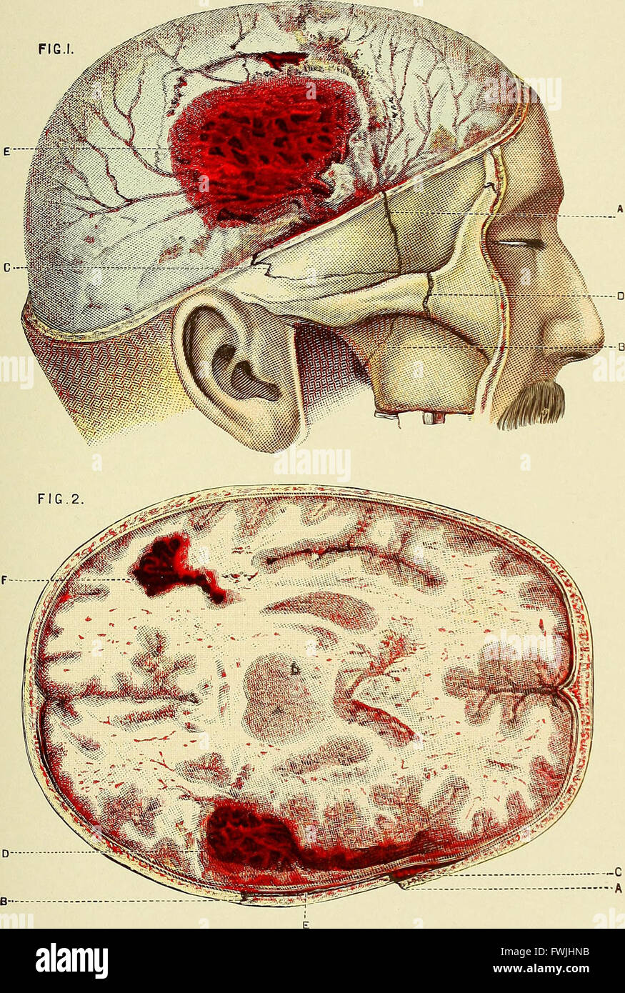 A 1899 manual on modern surgery, outlining current medical procedures ...