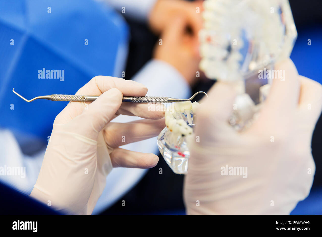 close up of dentist with teeth and dental probe Stock Photo - Alamy