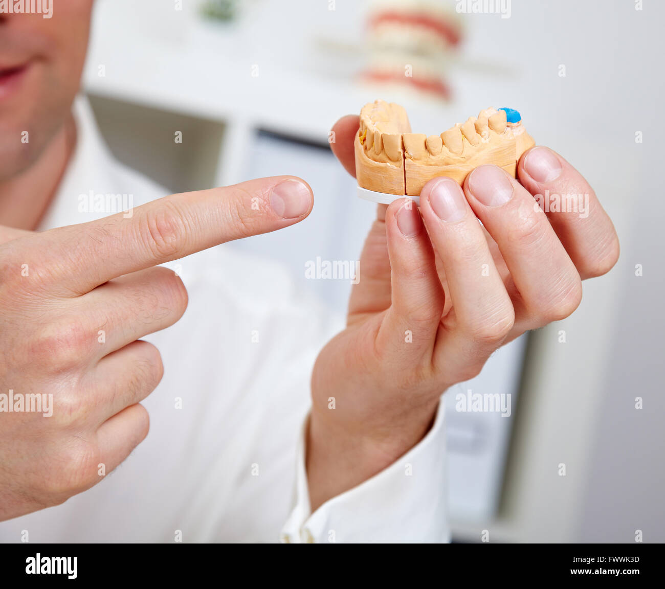 Dentist showing tooth implant model hi-res stock photography and images ...