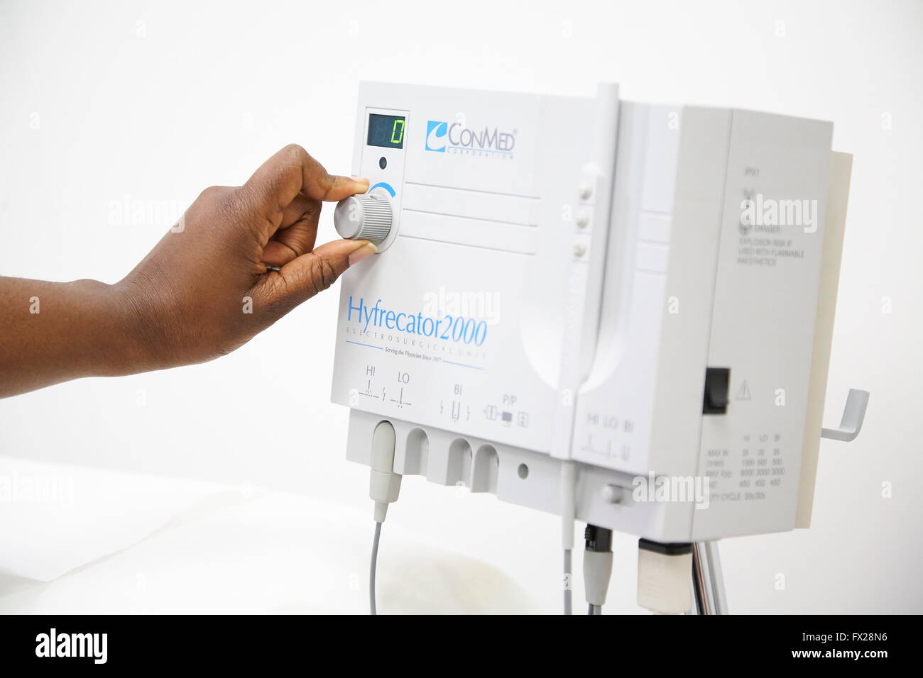 Person operating a hyfrecator 2000 in a hospital, used for various ...
