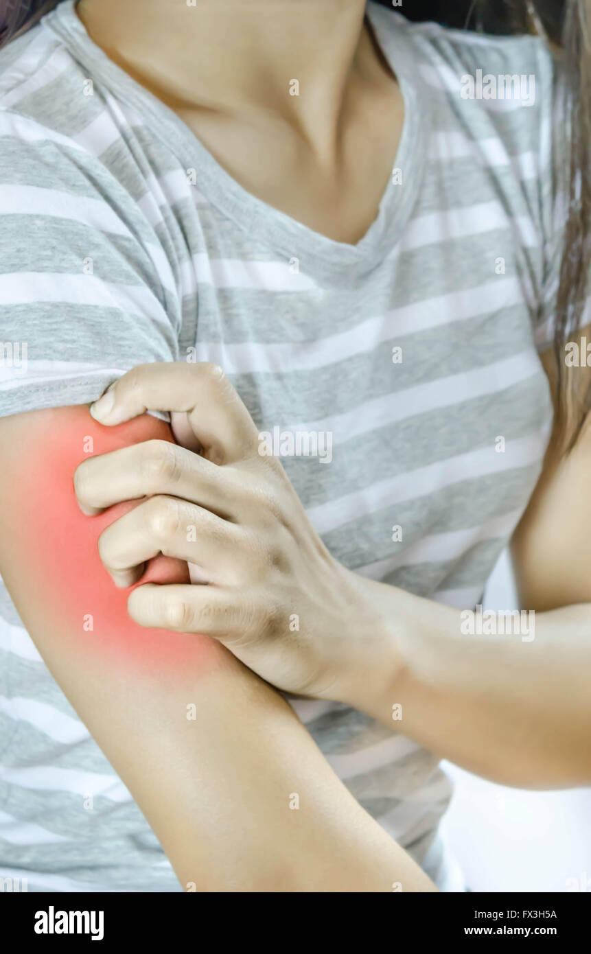 Scratching arm hi-res stock photography and images - Alamy