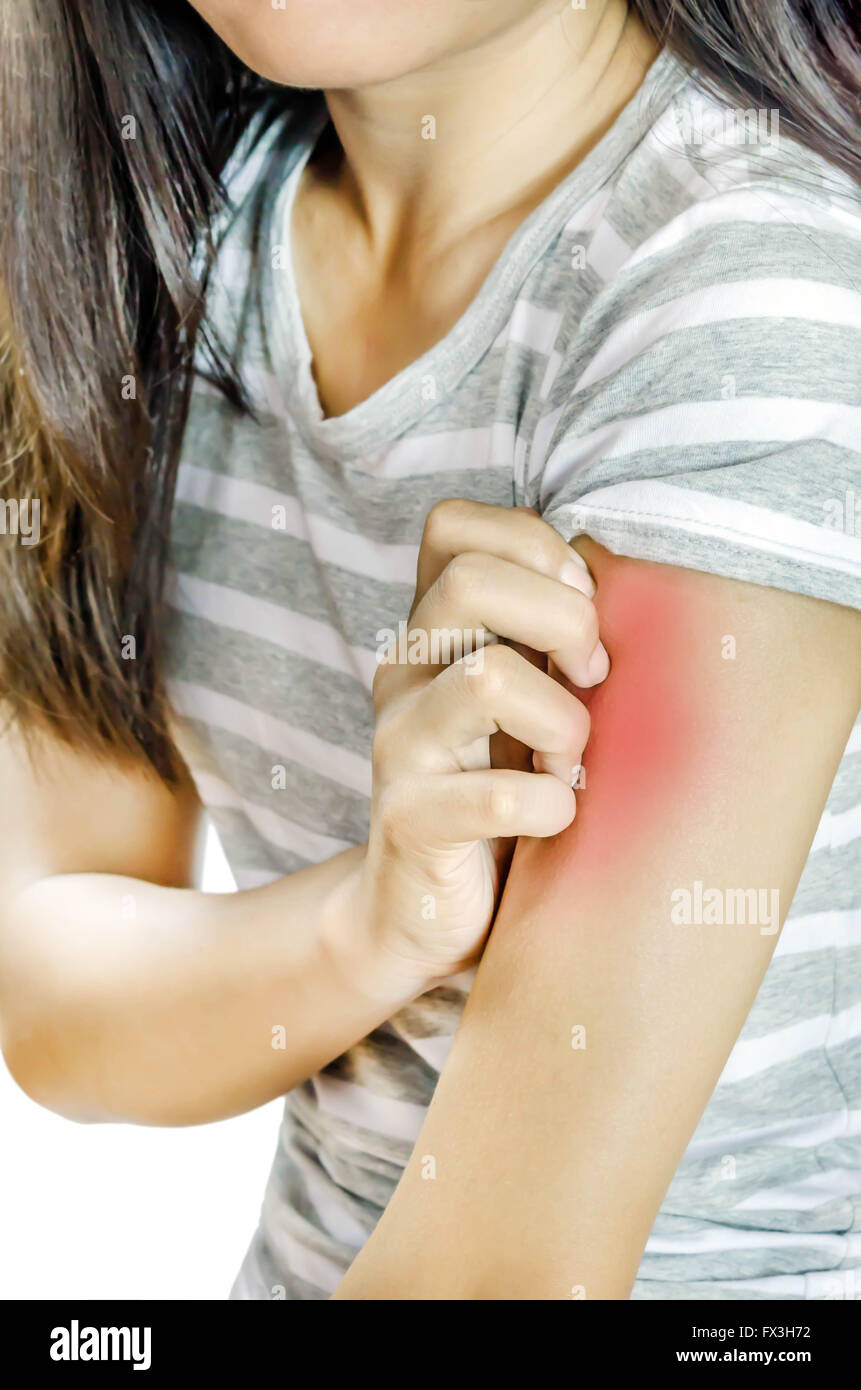 Scratching arm hi-res stock photography and images - Alamy