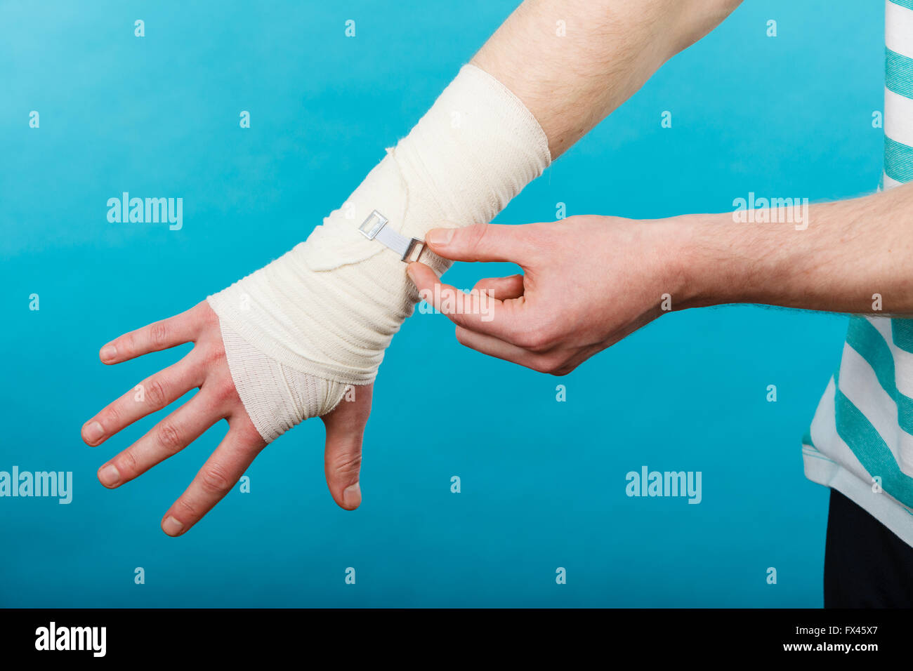 Fractures and dislocations concept. Male hand in white bandage. Helpful ...