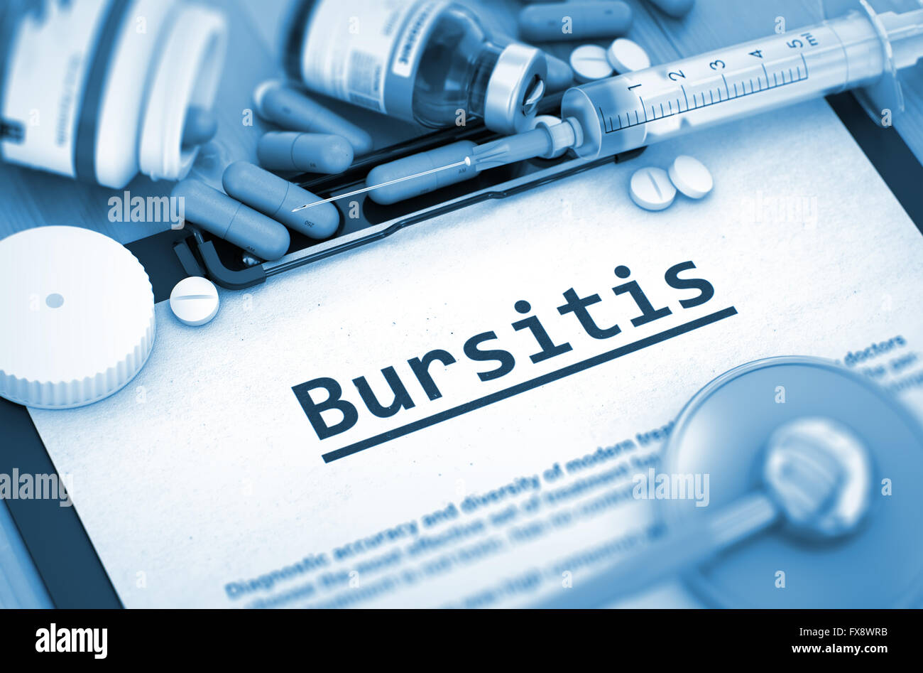 Bursitis hi-res stock photography and images - Alamy