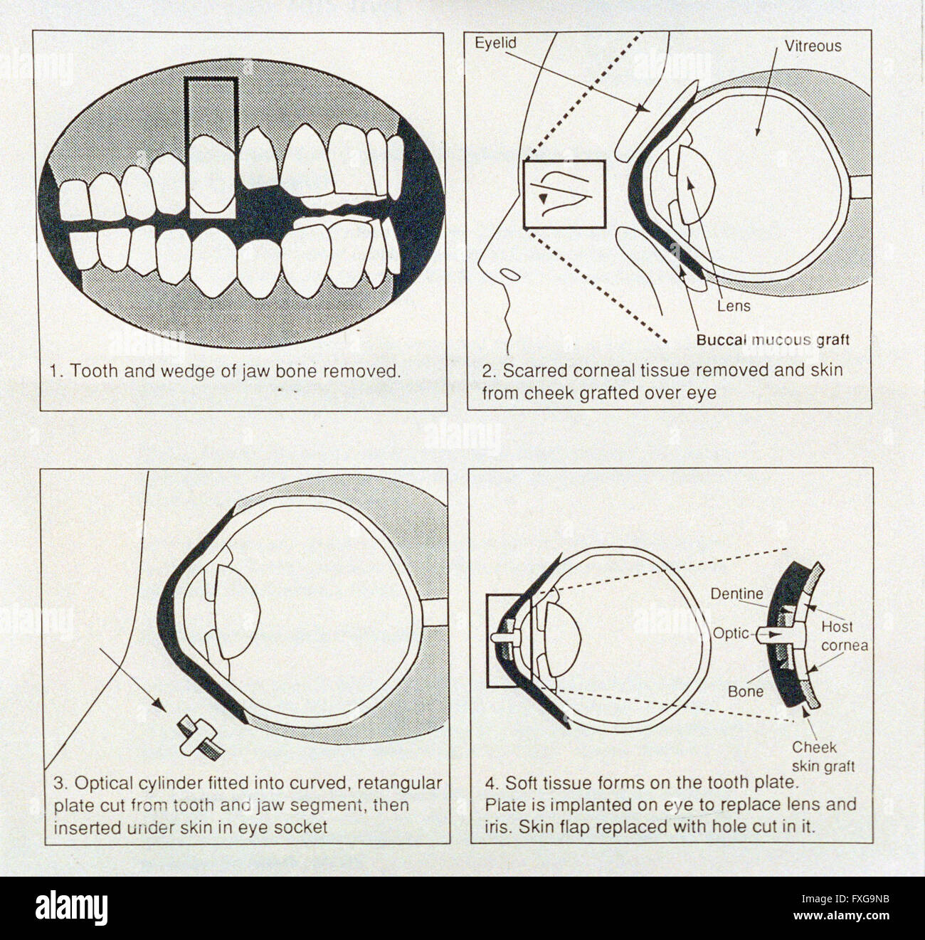 Illustration showing the incredible operation performed on Mr Varsani ...
