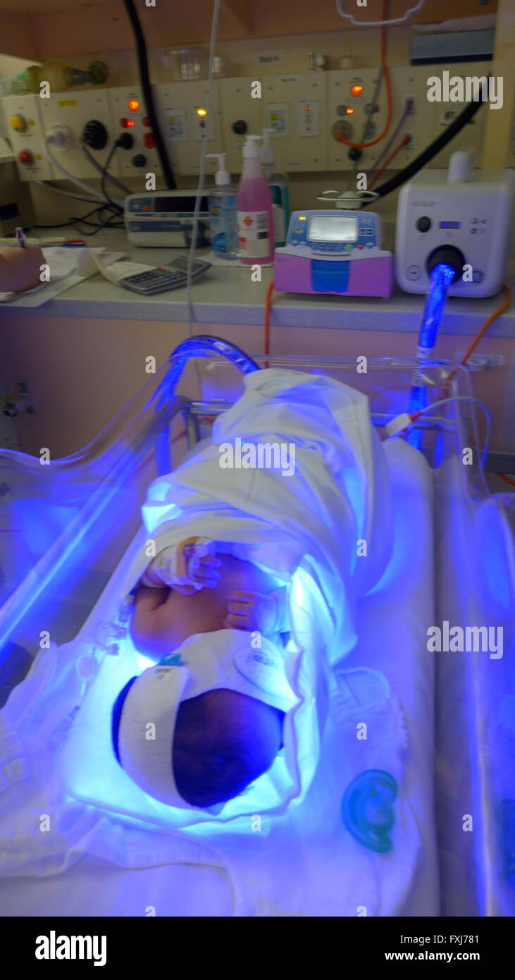 Baby Intensive Care Unit UV Light Treatment Stock Photo - Alamy