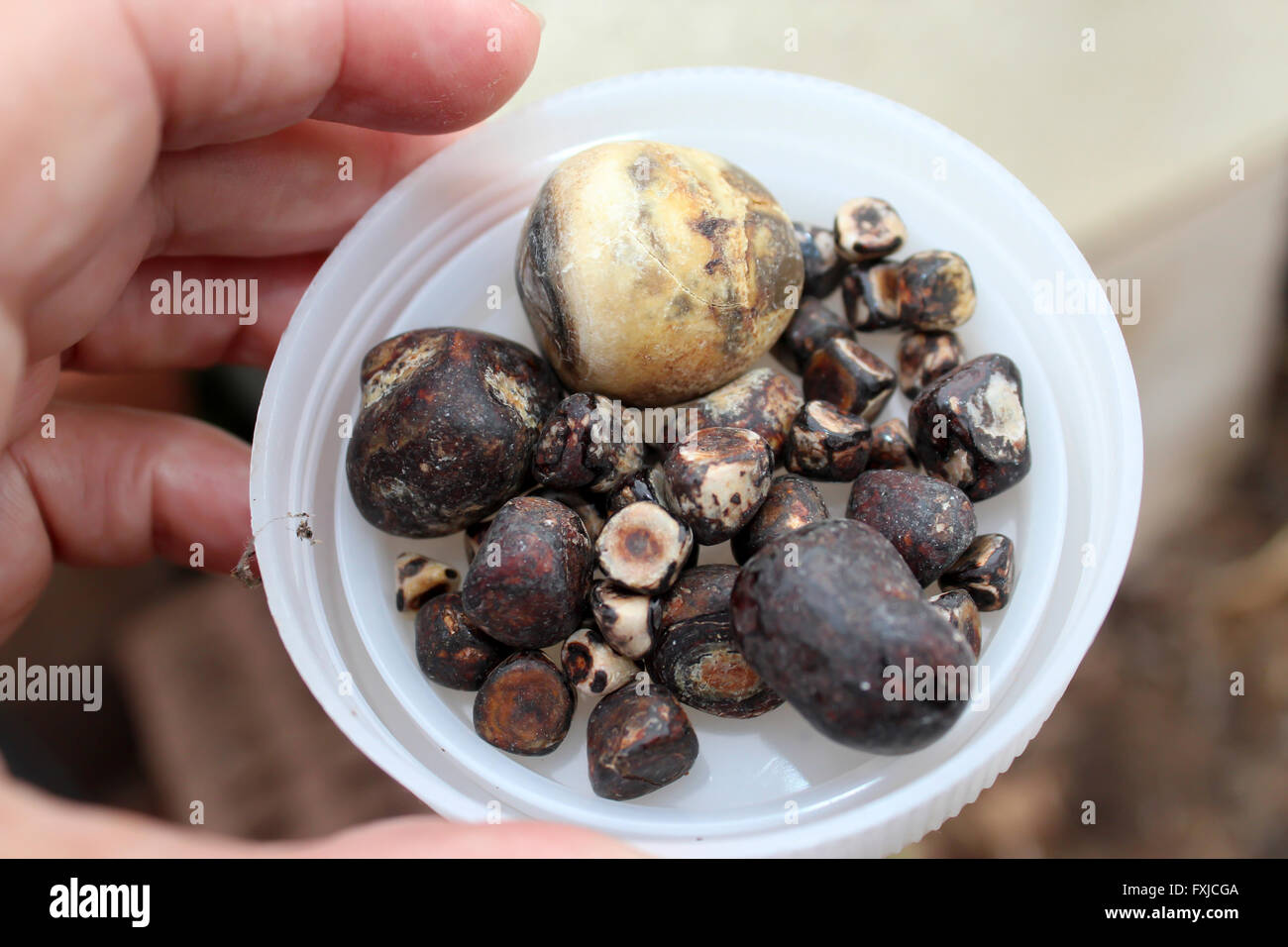 Gallstones small, hard crystalline mass formed in the gall bladder ...