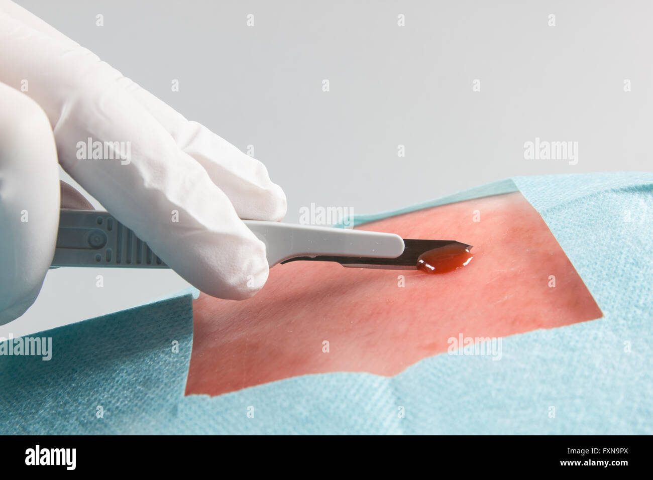 Scalpel doctor hi-res stock photography and images - Alamy