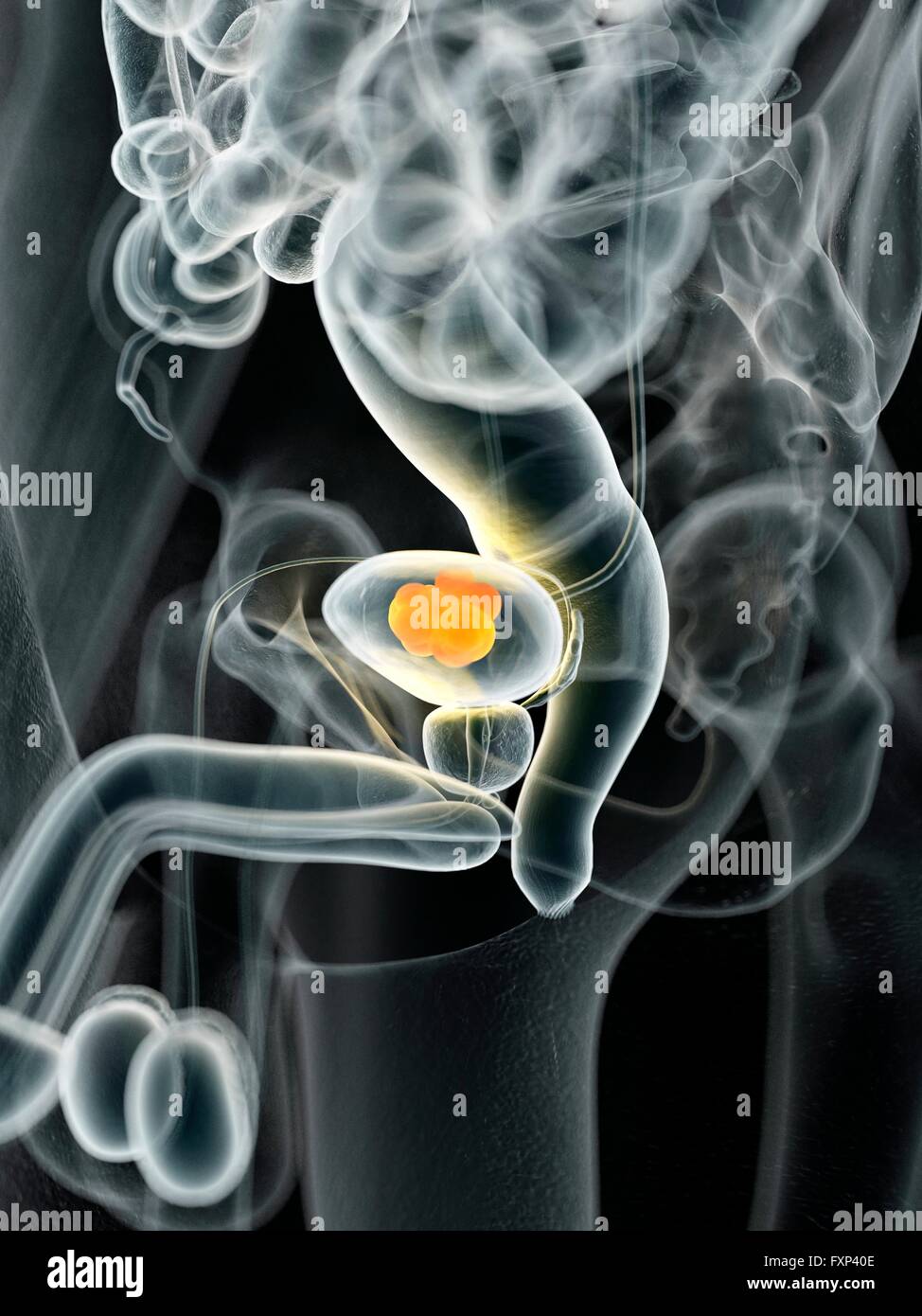 Bladder cancer hi-res stock photography and images - Alamy