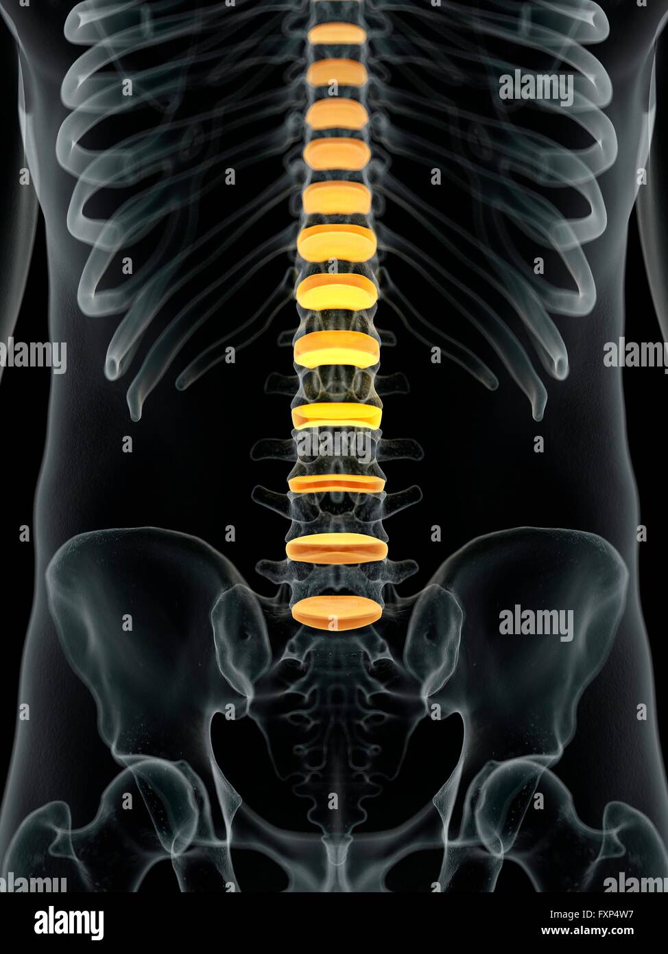 Human spinal intervertebral discs, computer illustration Stock Photo ...