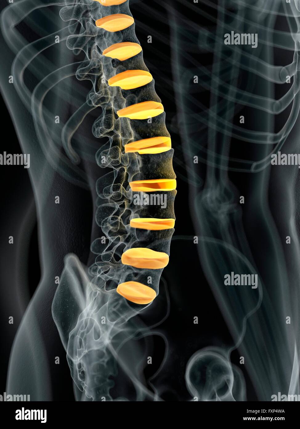 Human spinal intervertebral discs, computer illustration Stock Photo ...