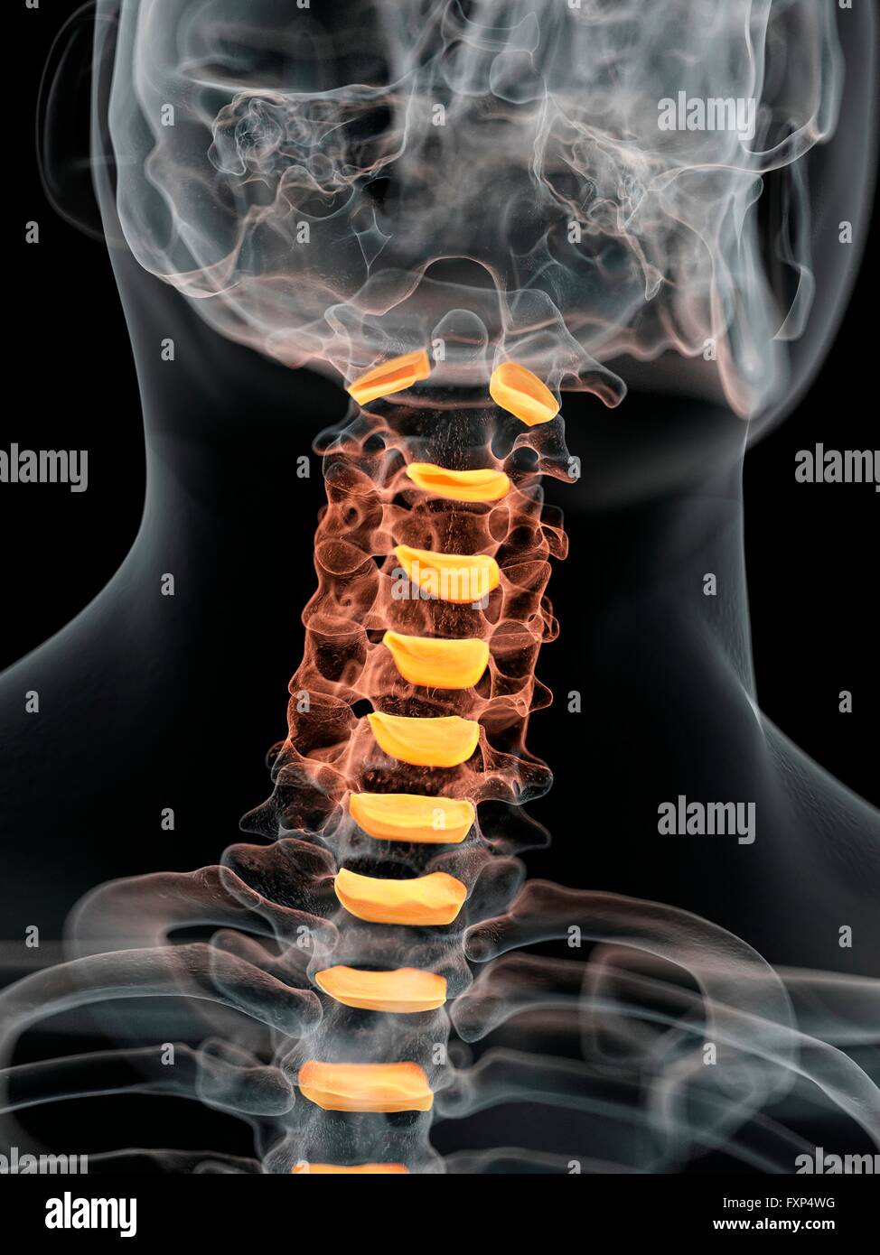 Human intervertebral discs of the neck, computer illustration Stock ...