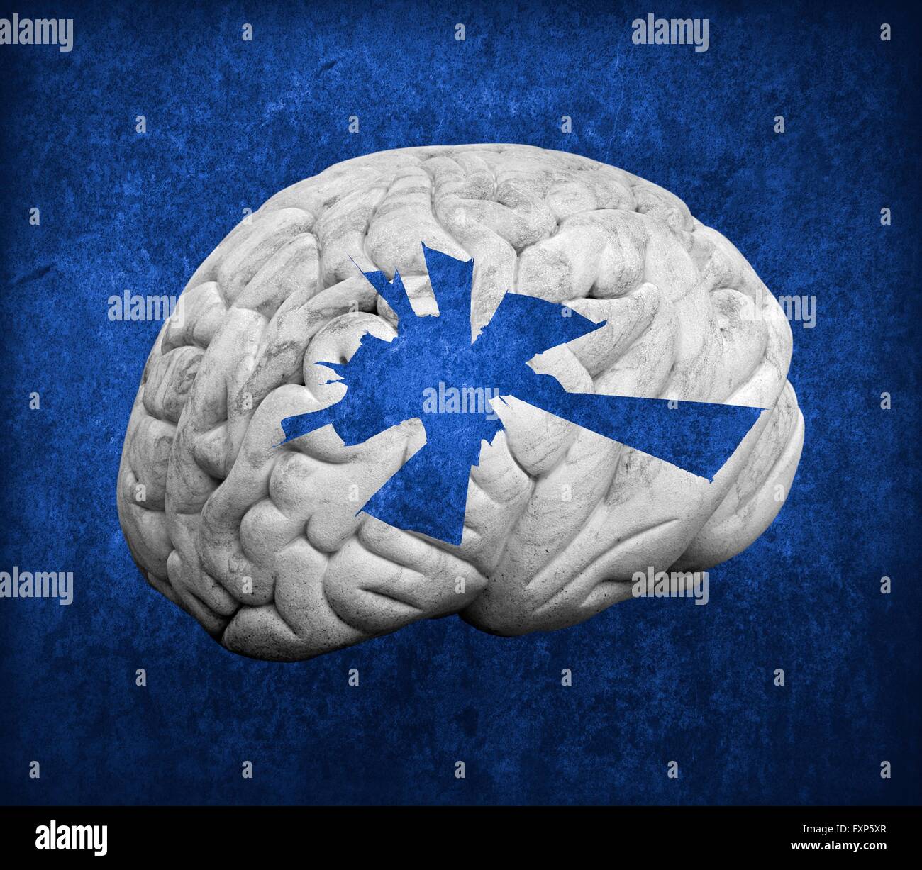 Damaged human brain, computer artwork Stock Photo - Alamy