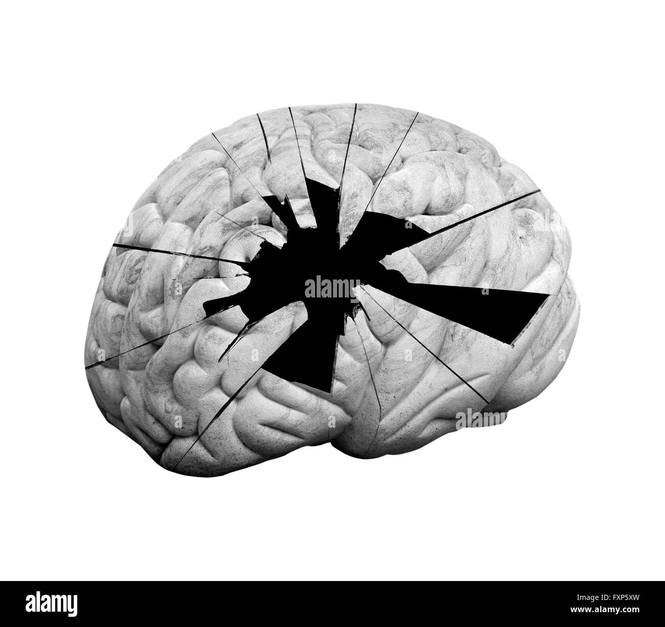 Damaged human brain, computer artwork Stock Photo - Alamy