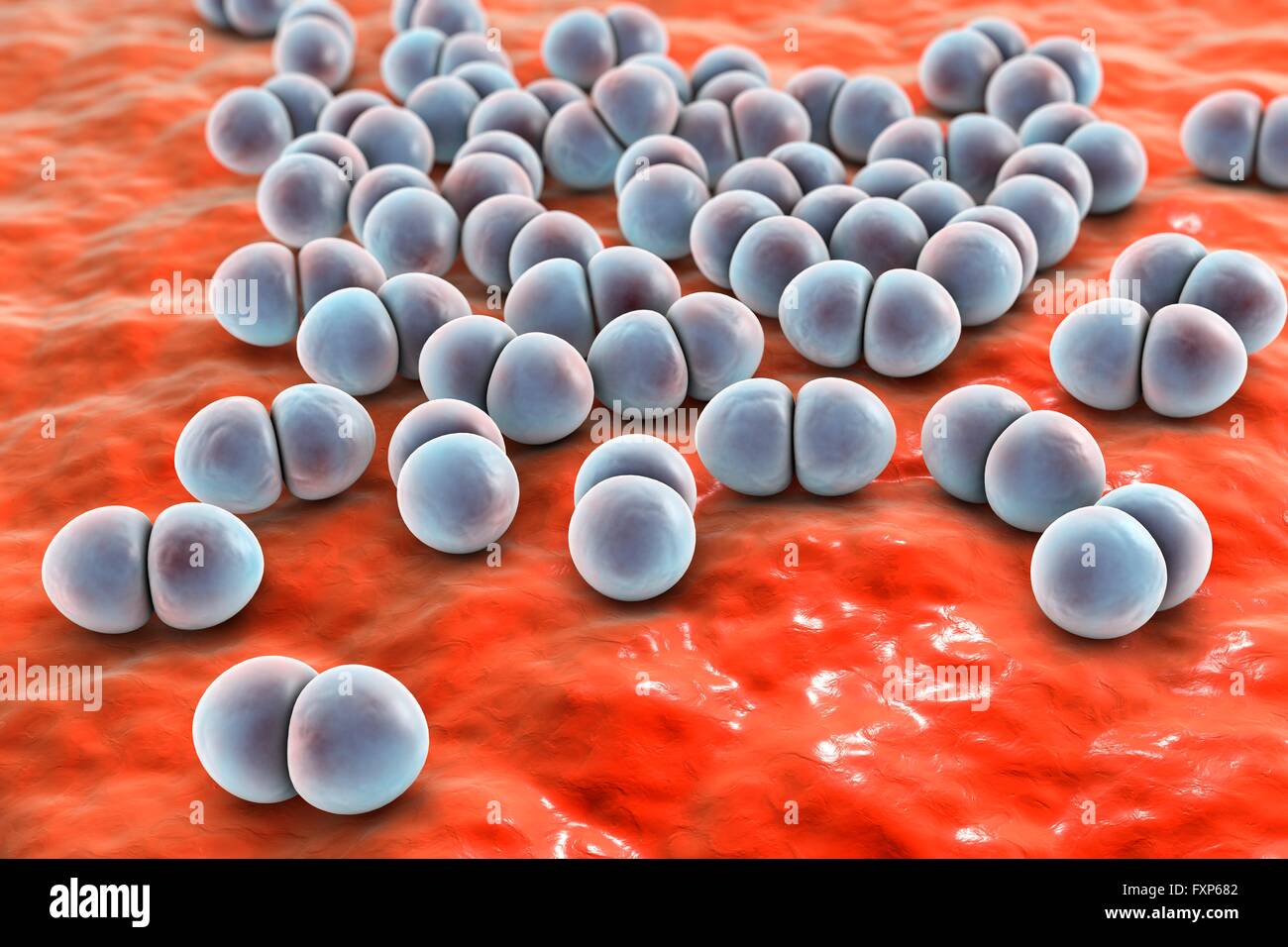Computer illustration of Pneumococci (Streptococcus pneumoniae ...