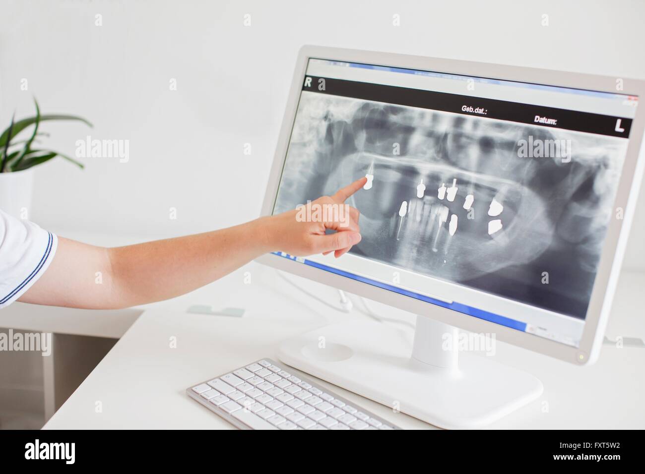 X ray screen hi-res stock photography and images - Alamy