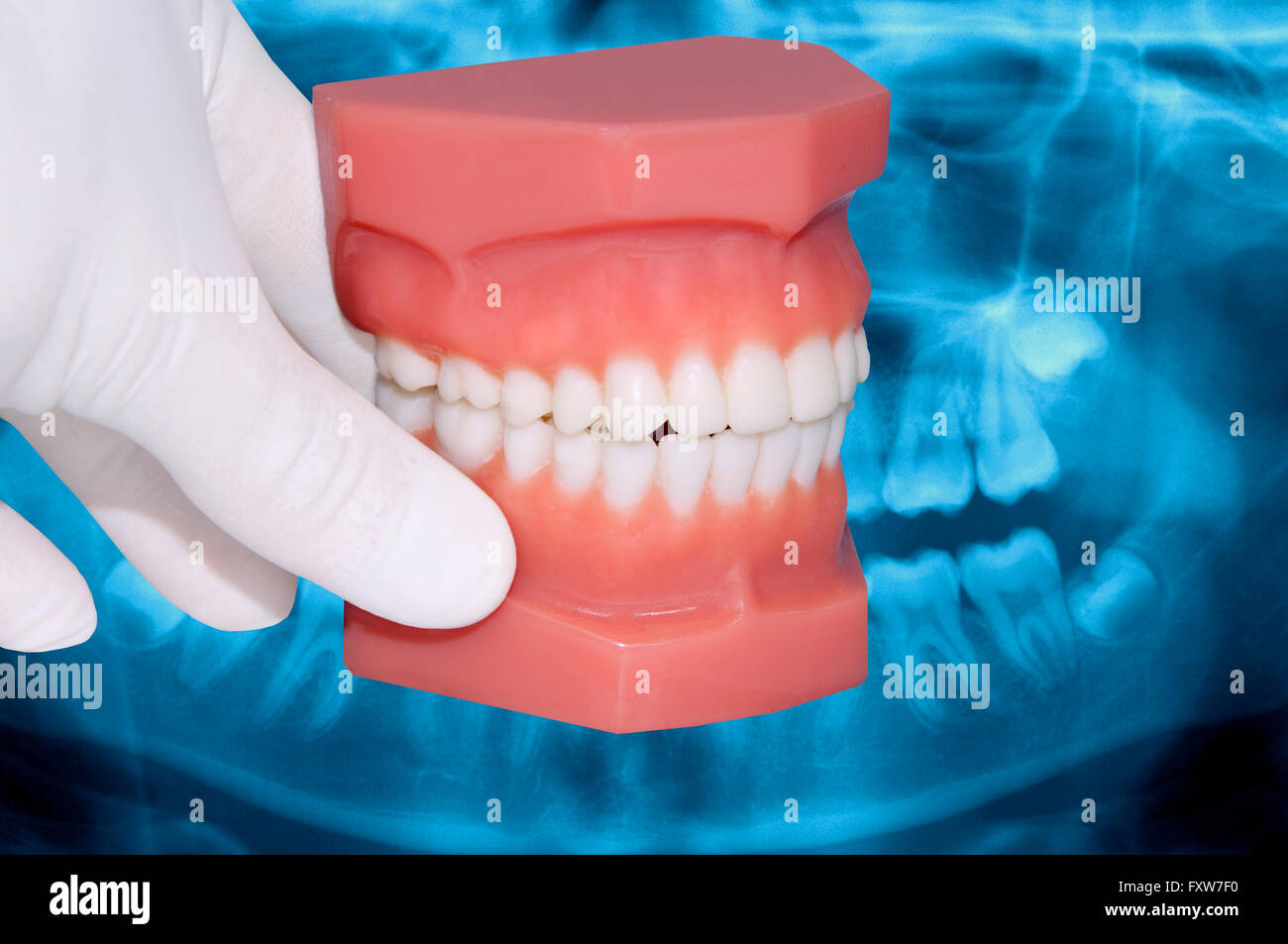 Dental radiography hi-res stock photography and images - Alamy