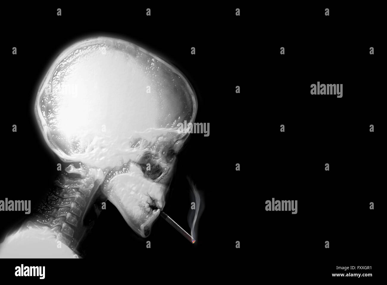 human x-ray smoking cigarette Stock Photo - Alamy
