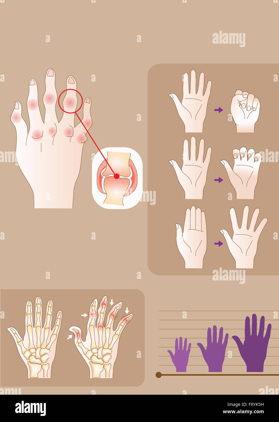 Arrow bone hand hi-res stock photography and images - Alamy