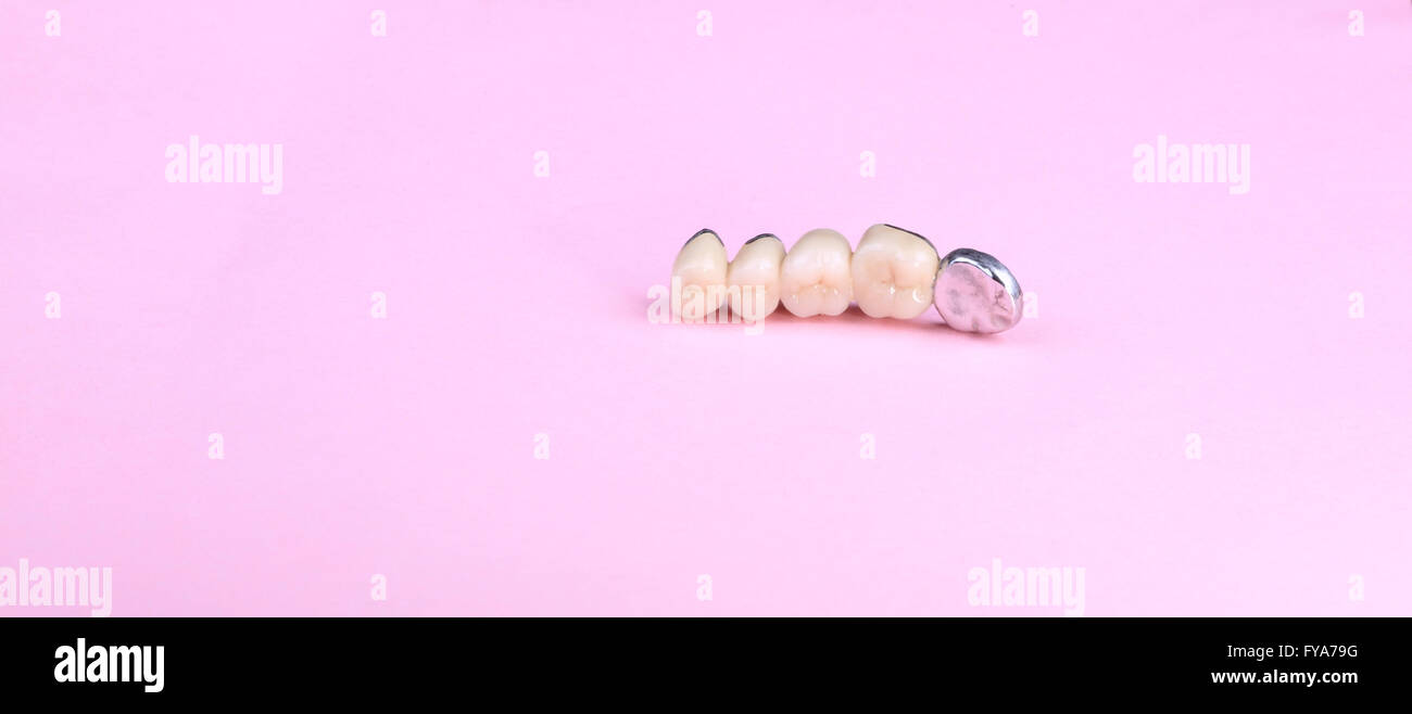 dental prosthesis on pink background Stock Photo - Alamy