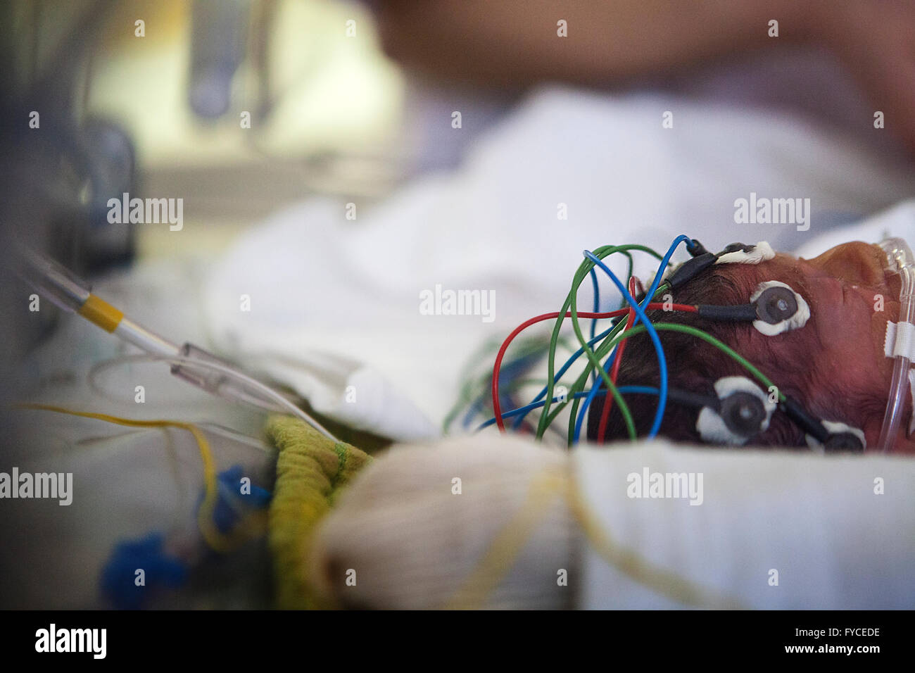 Electrodes baby head hi-res stock photography and images - Alamy