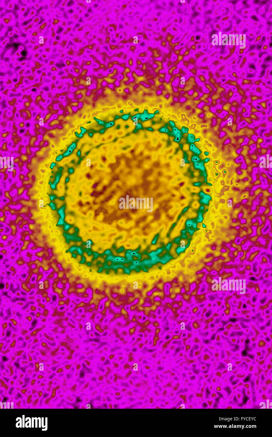 Dengue fever virus micrograph hi-res stock photography and images - Alamy