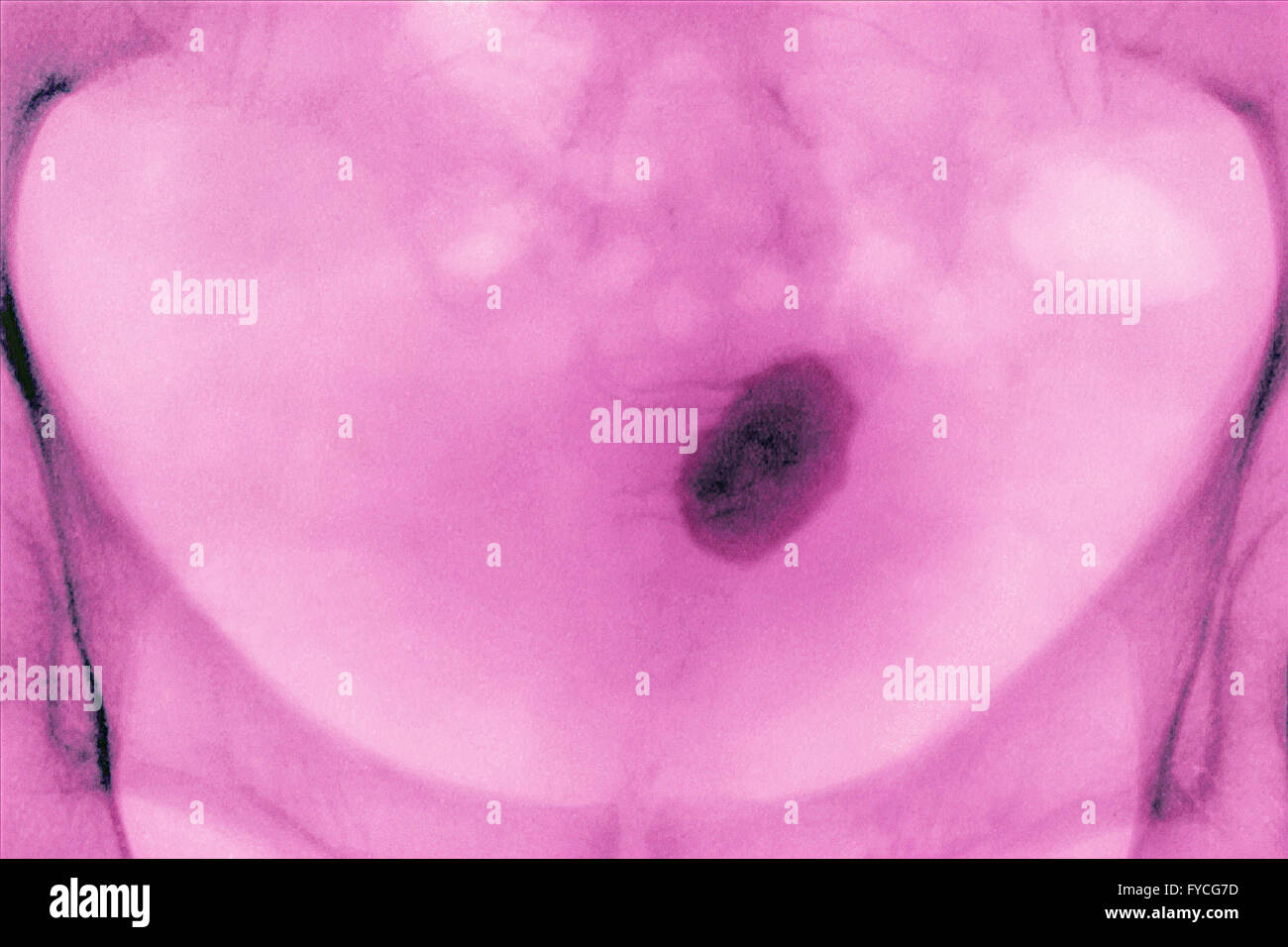 Calculus hi-res stock photography and images - Alamy