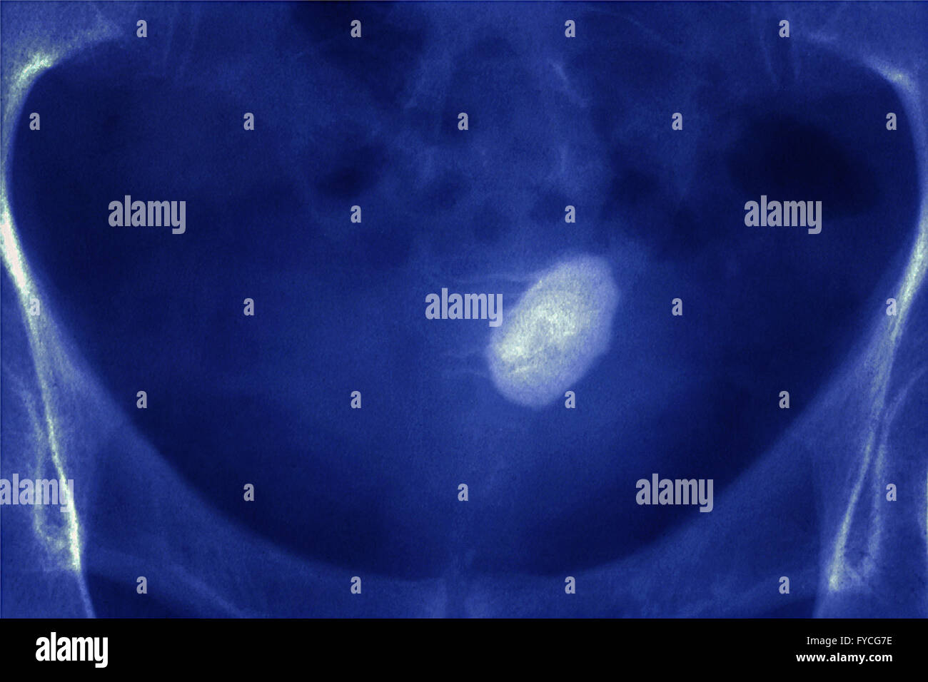 Calculus hi-res stock photography and images - Alamy