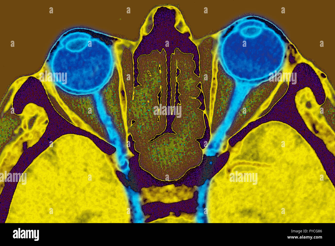 Computed tomography hi-res stock photography and images - Alamy