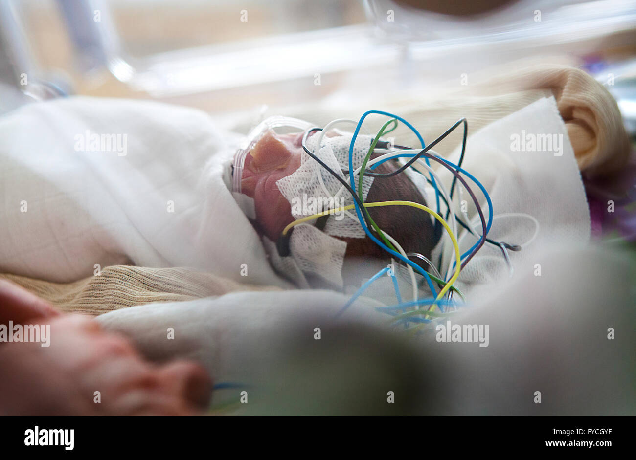 Child electrode head hi-res stock photography and images - Alamy