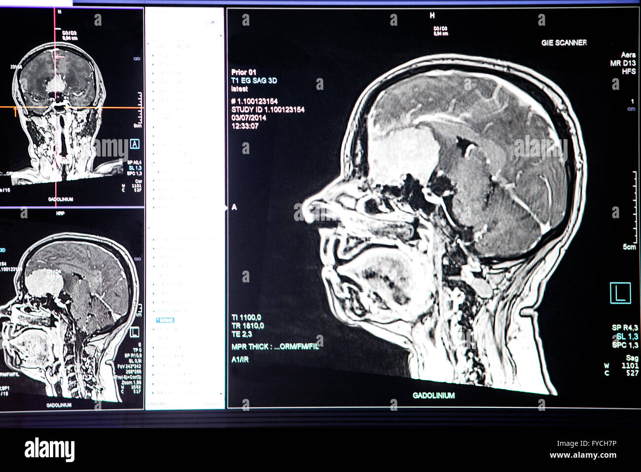 Closeup examination hi-res stock photography and images - Alamy
