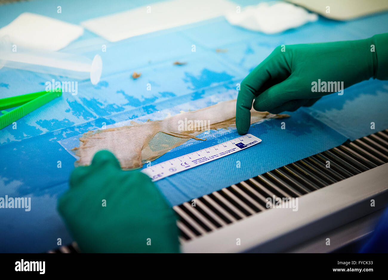 Skin graft laboratory hi-res stock photography and images - Alamy