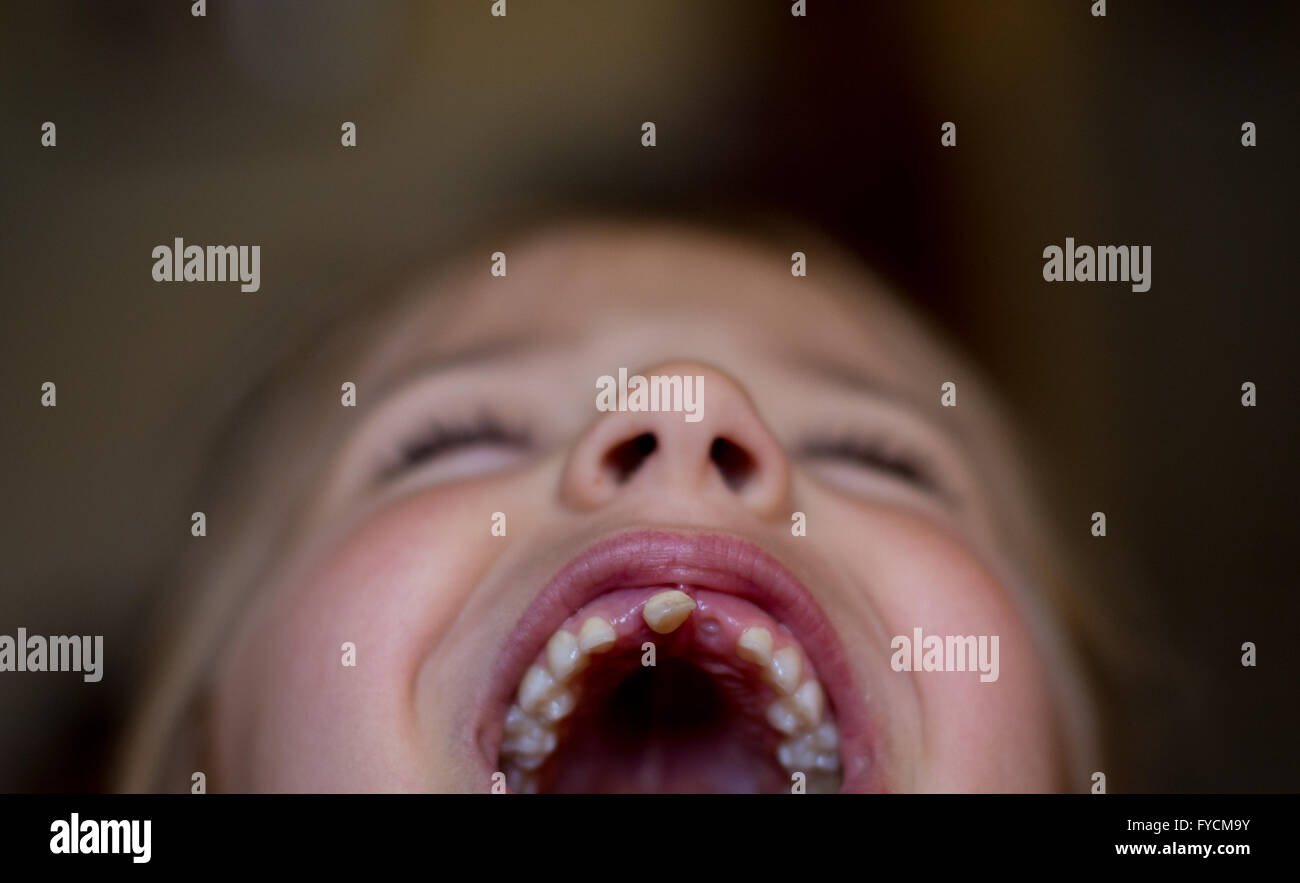 Teeth Falling Out High Resolution Stock Photography and Images - Alamy