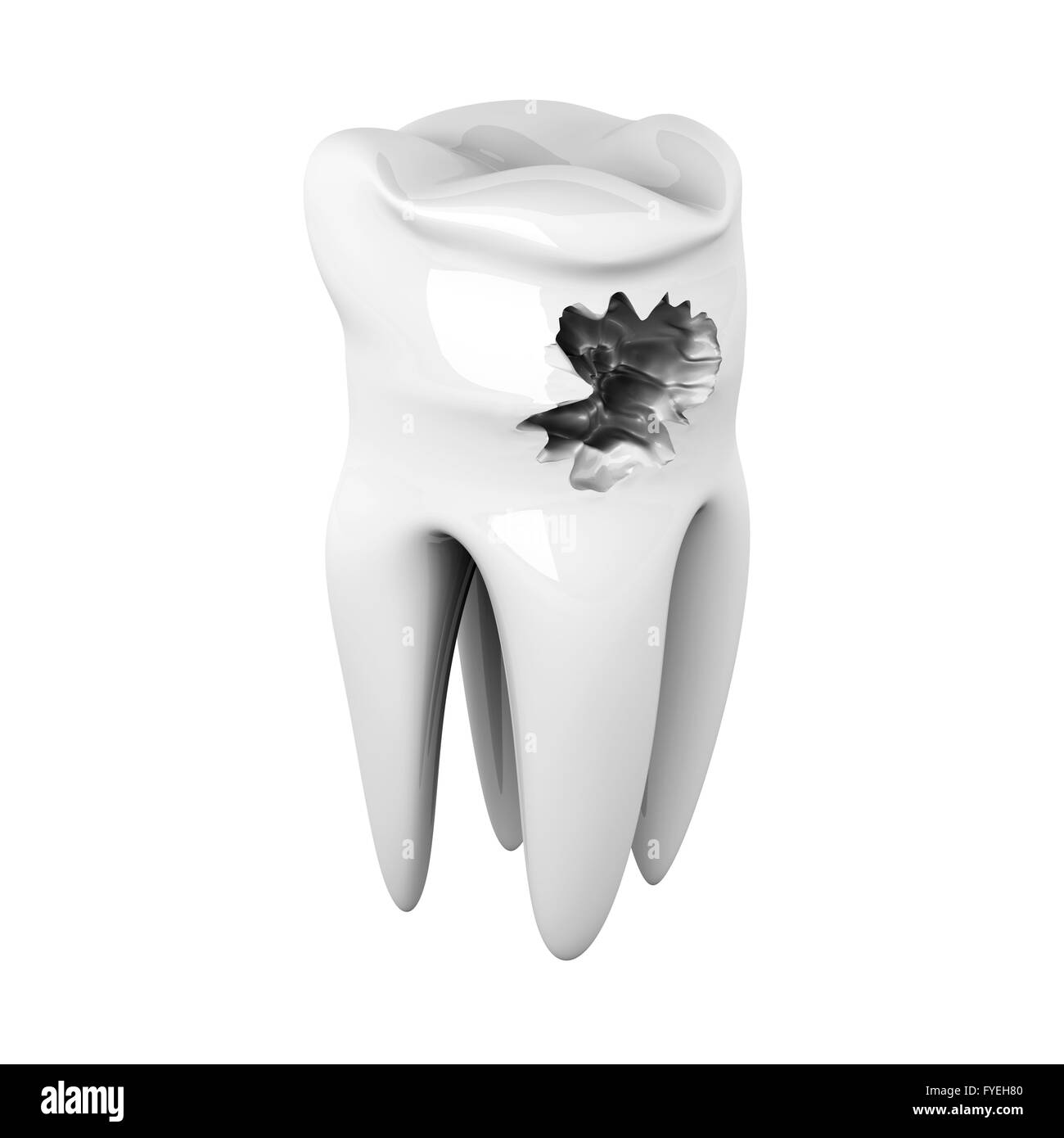 Anatomy tooth caries Black and White Stock Photos & Images - Alamy