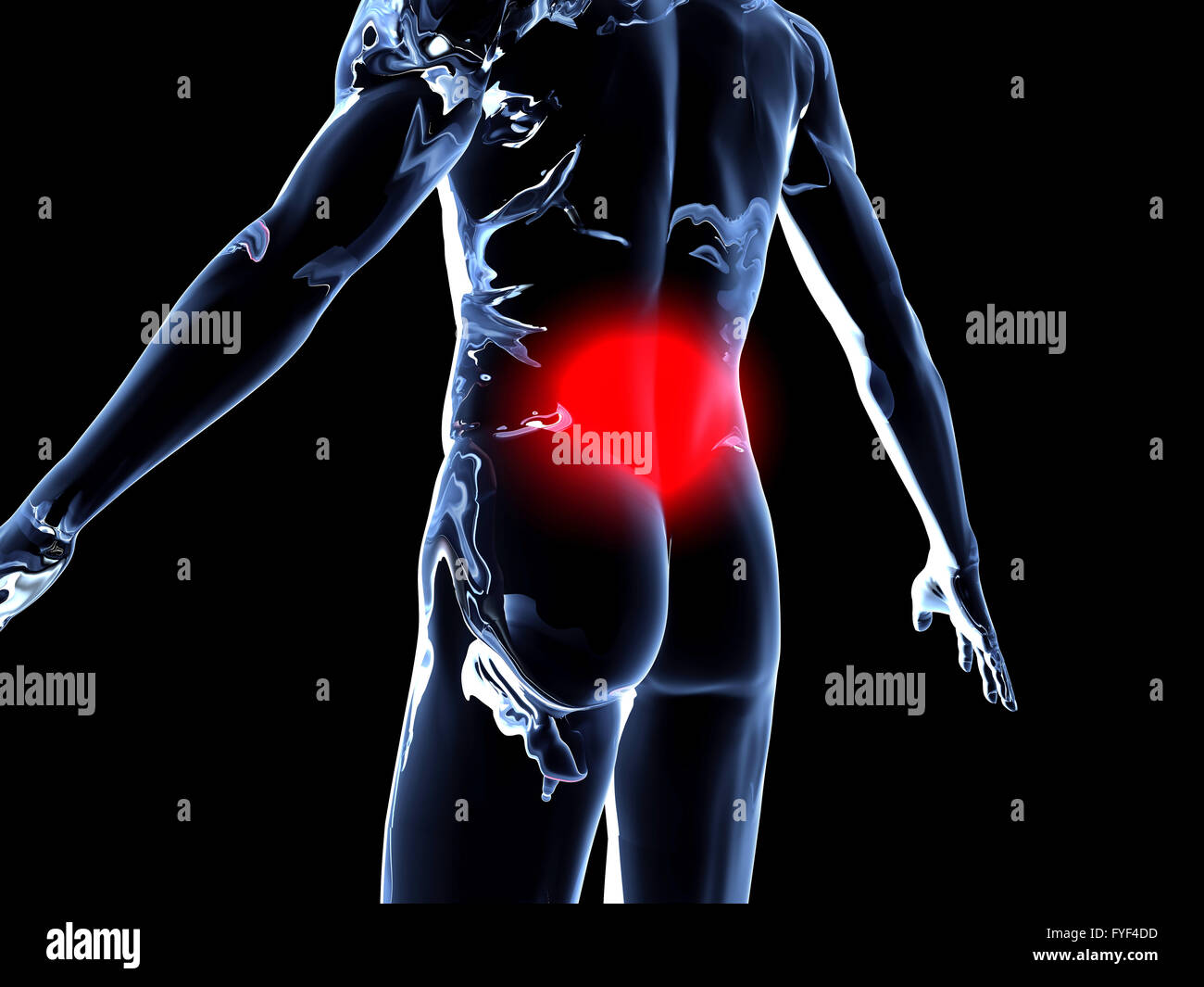 Back Ache - Anatomy Stock Photo - Alamy