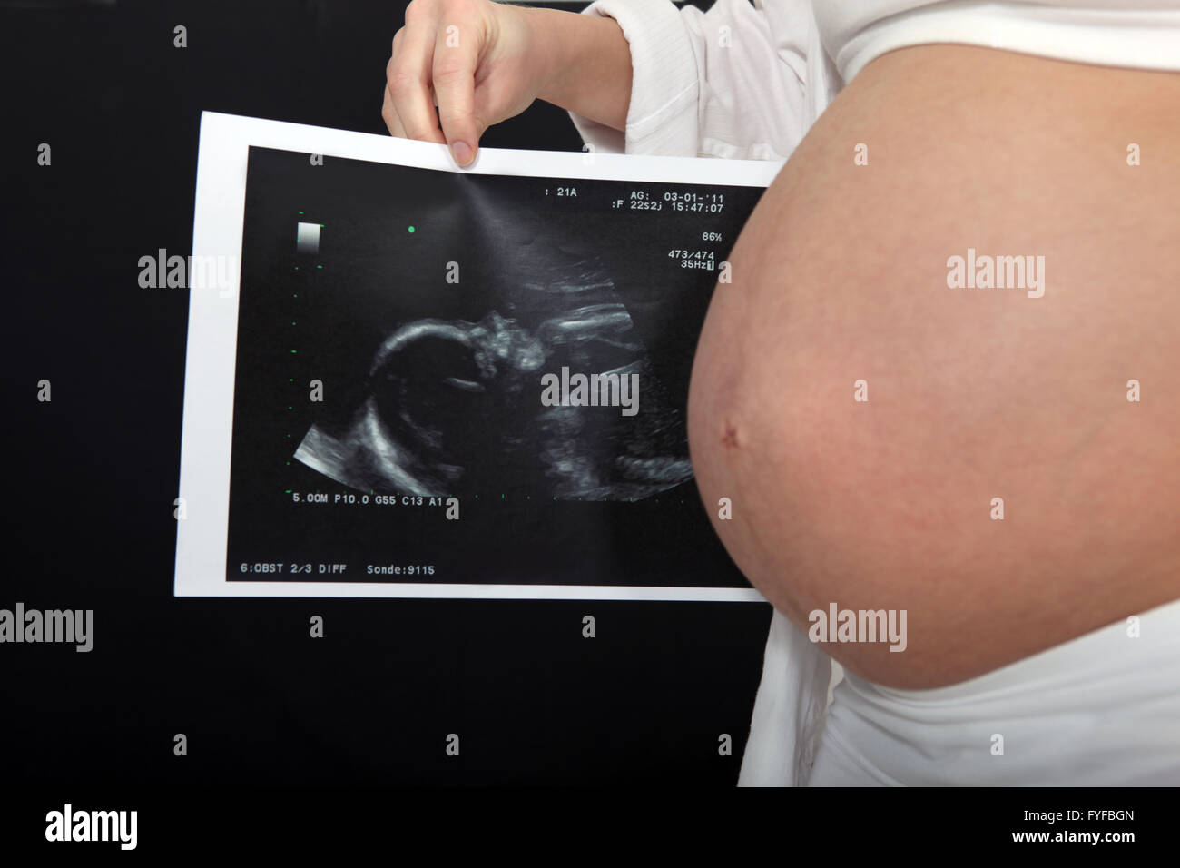 Obstetric sonogram hi-res stock photography and images - Alamy