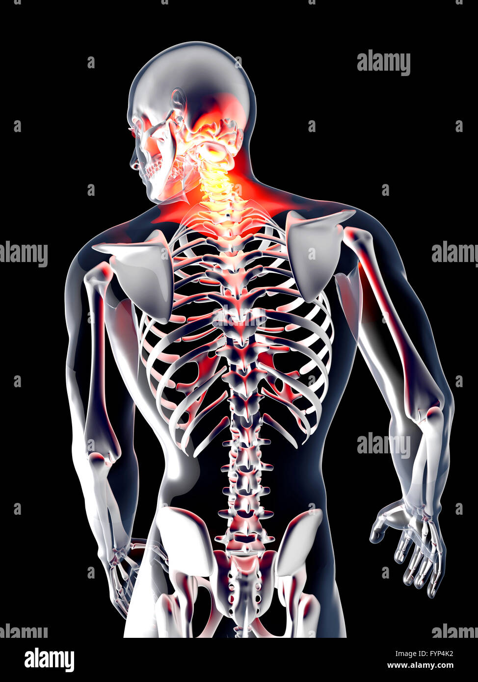 Anatomy - Back Pain Stock Photo - Alamy