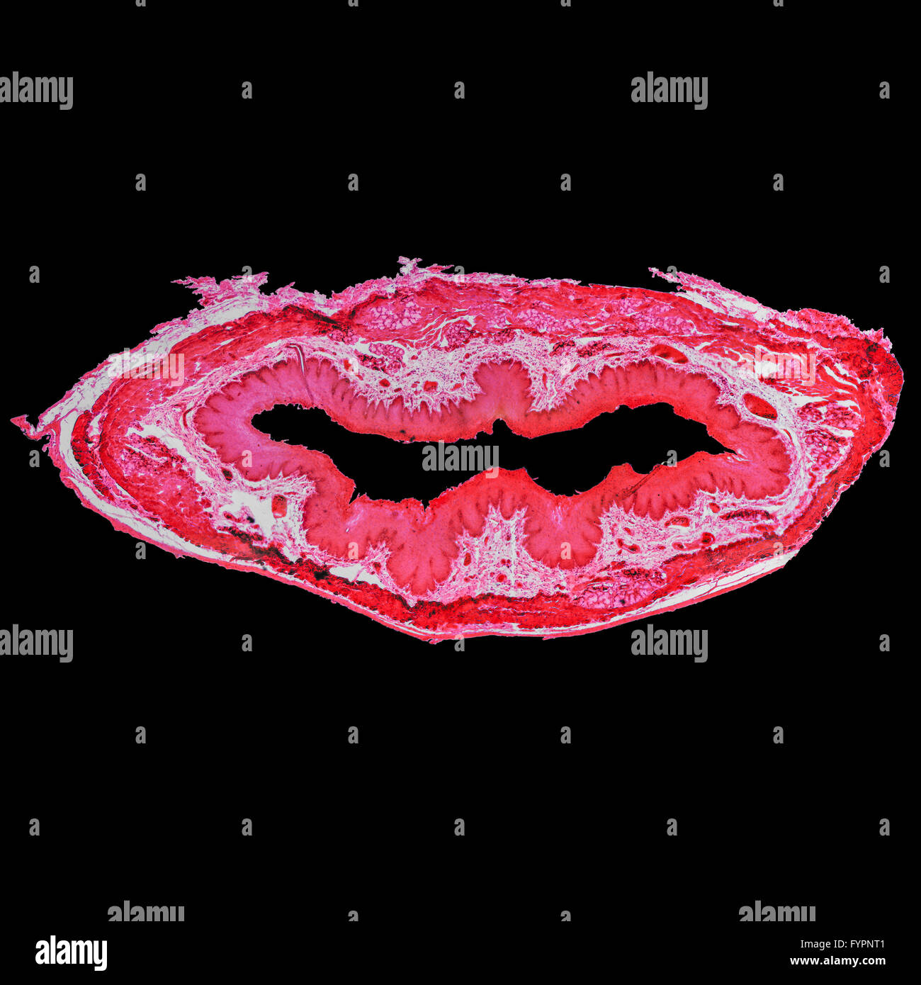 Epithelium micrograph hi-res stock photography and images - Alamy