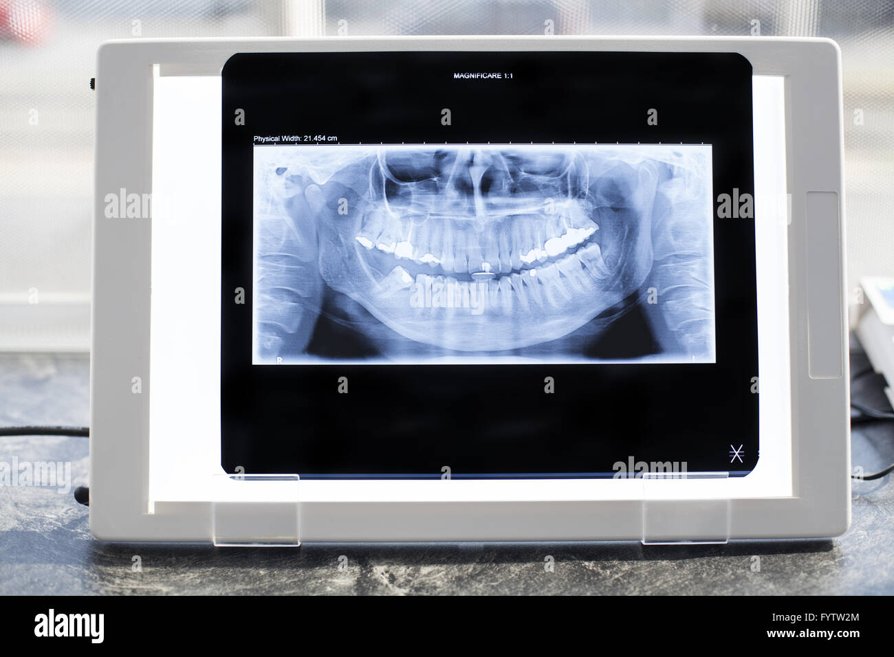 X ray viewer hi-res stock photography and images - Alamy