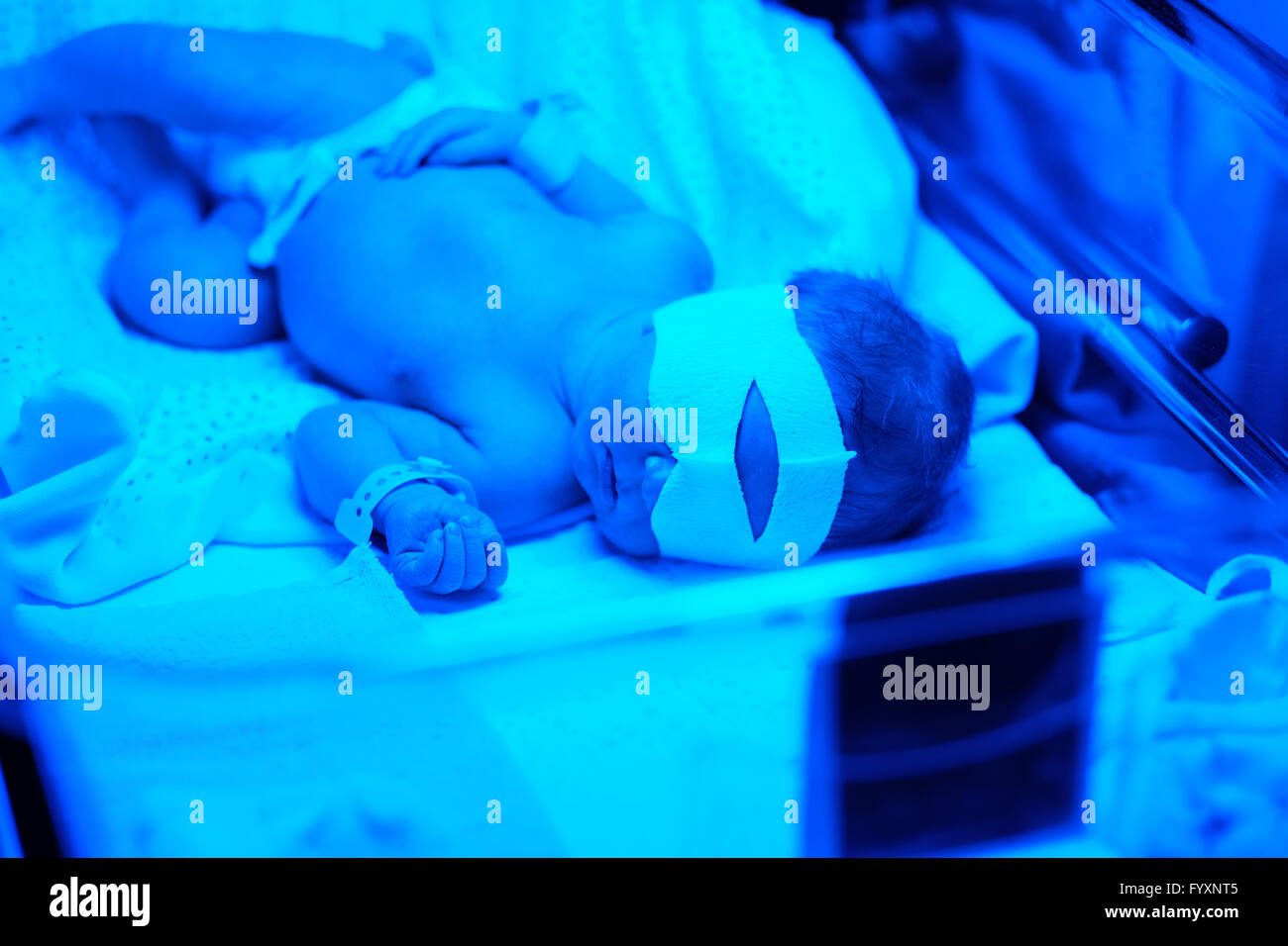 Newborn baby having photo theraphy Stock Photo - Alamy