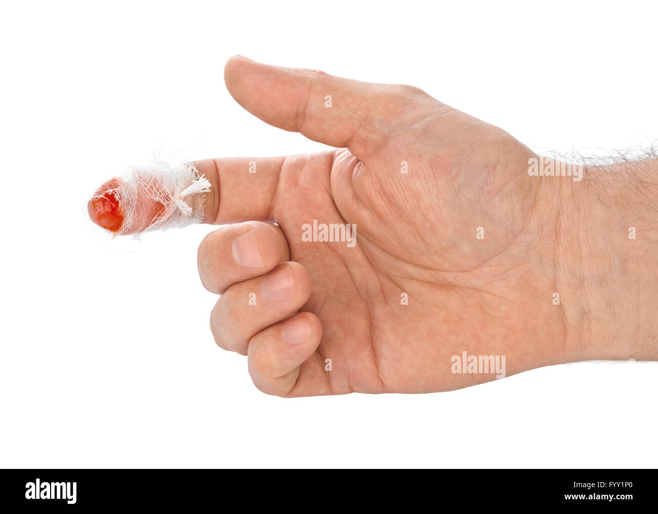 Hand with blood and bandage Stock Photo - Alamy