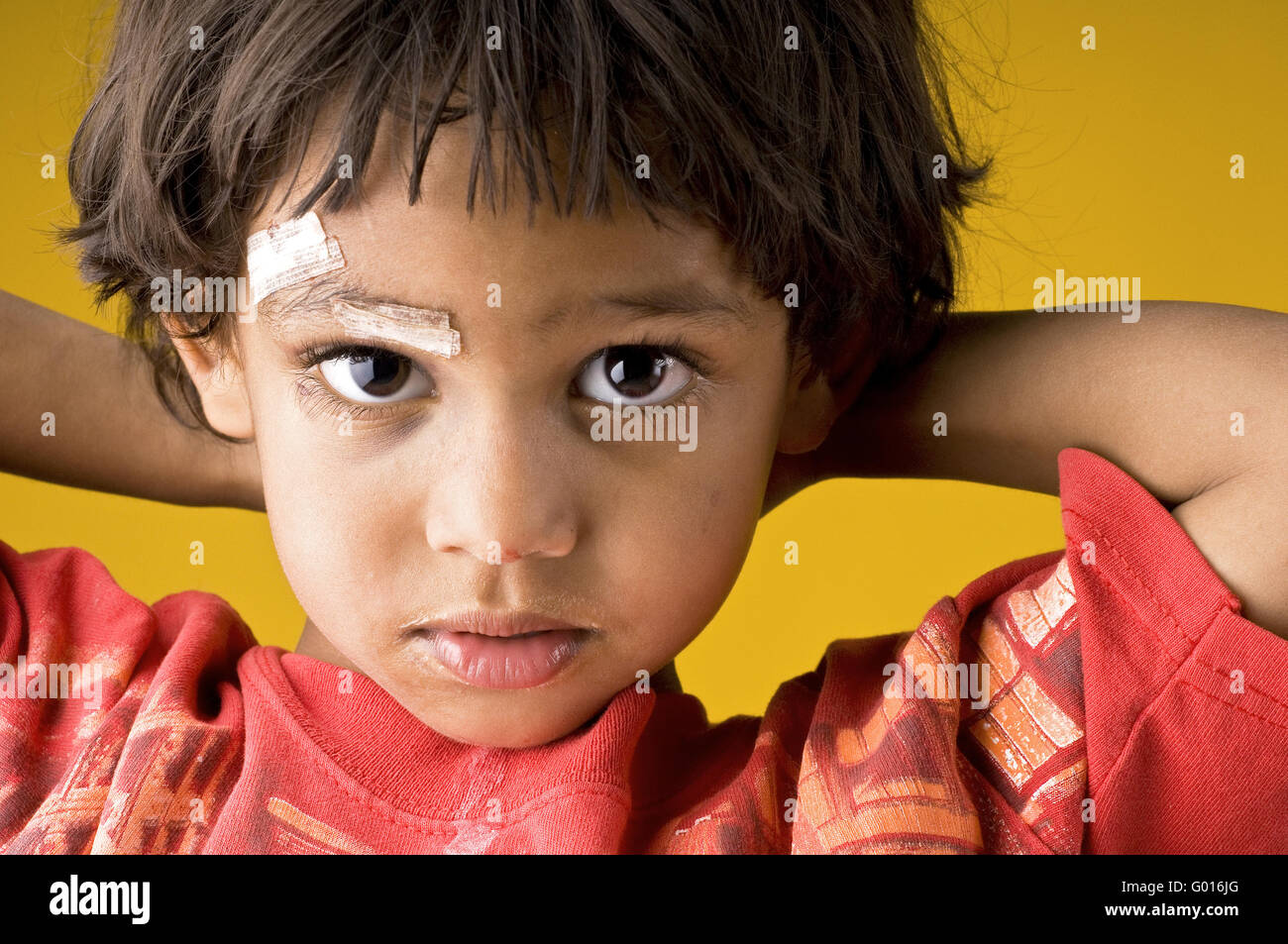 Face injuries hi-res stock photography and images - Alamy