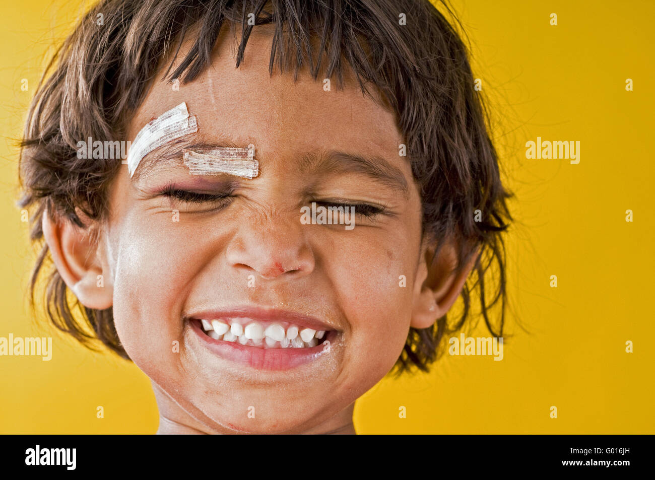 Facial wound hi-res stock photography and images - Alamy