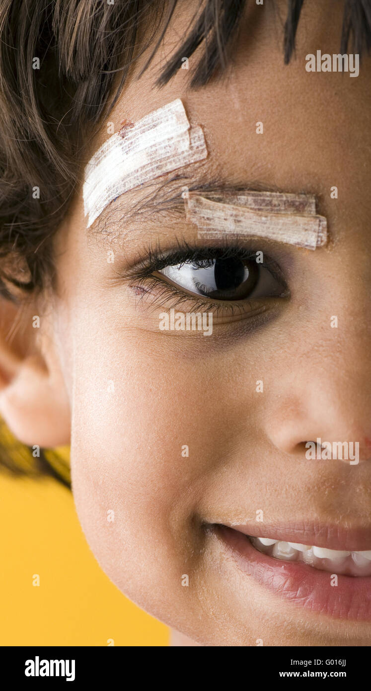 Platzwunde kopf hi-res stock photography and images - Alamy