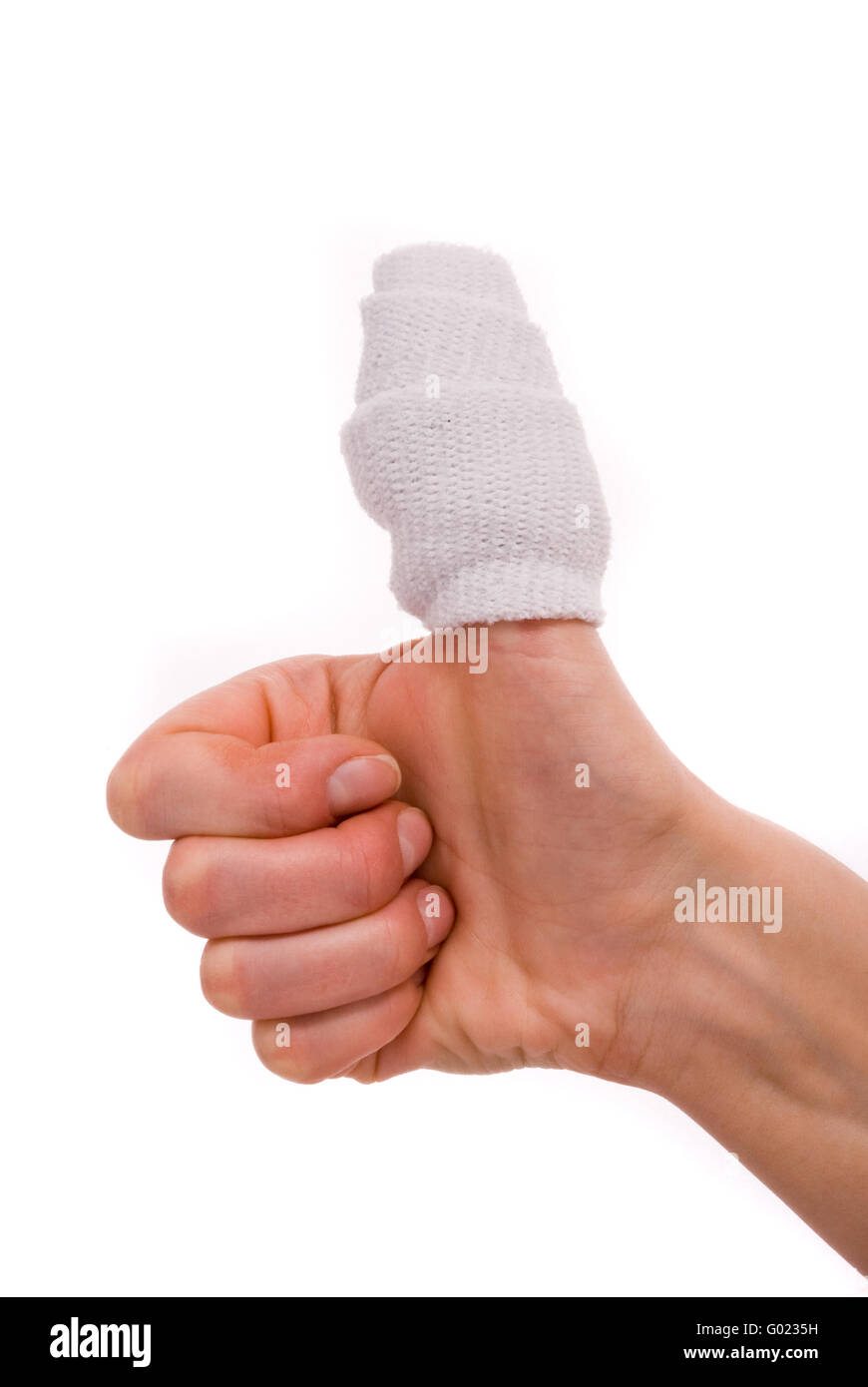 Broken Thumb X Ray High Resolution Stock Photography and Images - Alamy
