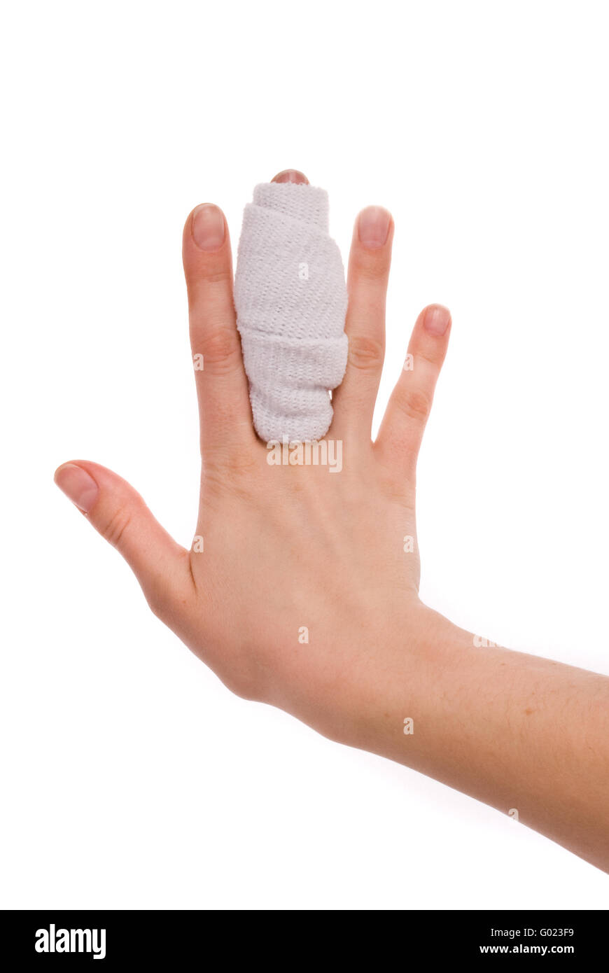 Wrist fracture x ray Cut Out Stock Images & Pictures - Alamy