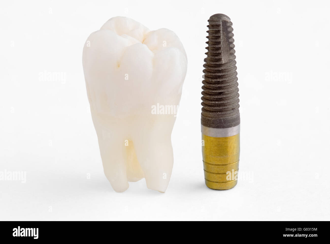 Real Human Wisdom tooth and Dental implant Stock Photo - Alamy