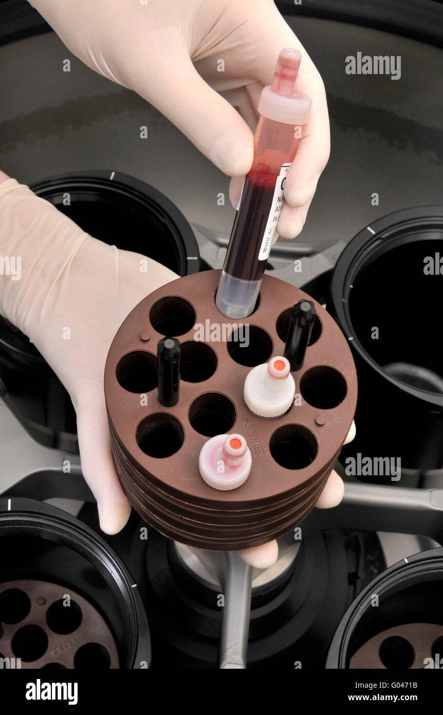 Biotechnology, centrifuge, blood sample, test tube, laboratory, company ...