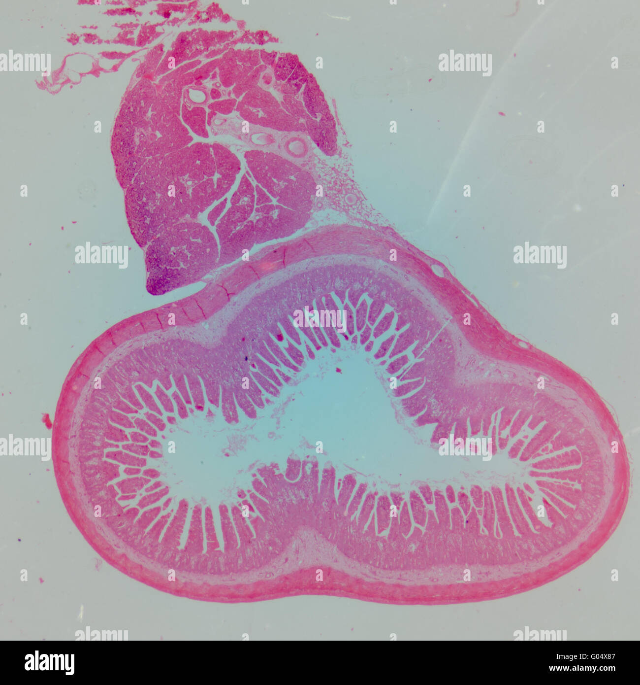 microscopic section of human small intestinum tenue tissue Stock Photo ...
