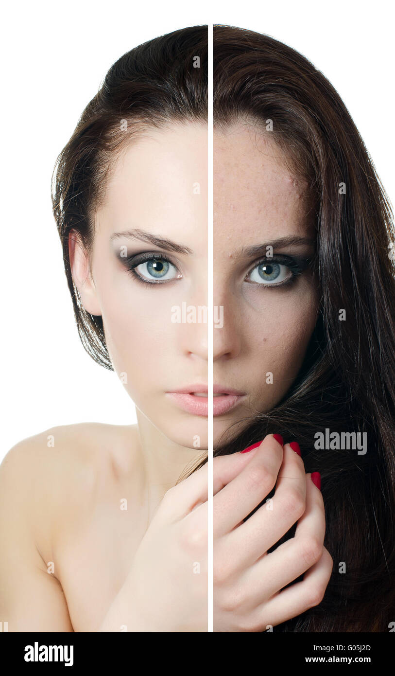 The beautiful girl with problems on the face Stock Photo - Alamy